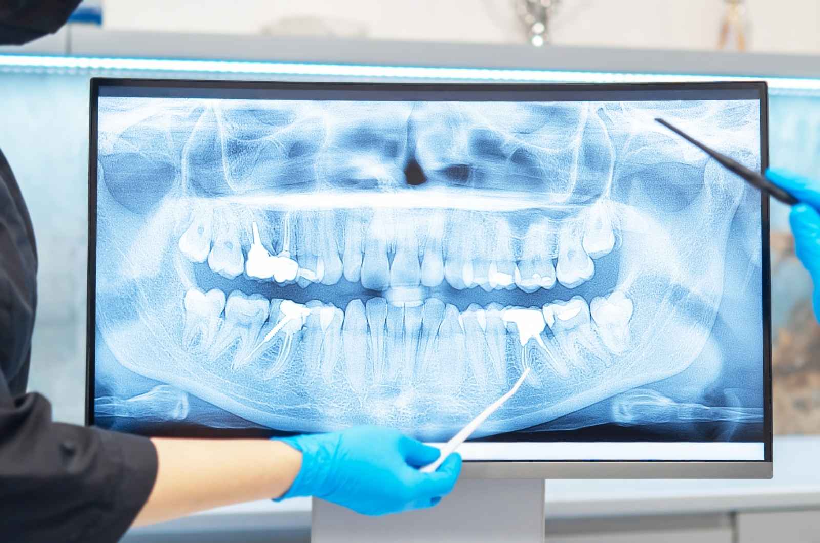 Are Mobile Dental CT Scans the Key to Advanced Dentistry? – מגזין מוצרי ...